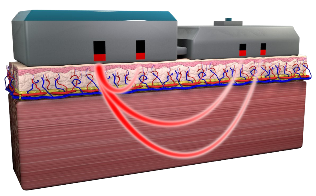 NIRSense Technology Uses Advanced Optical Sensing Techniques